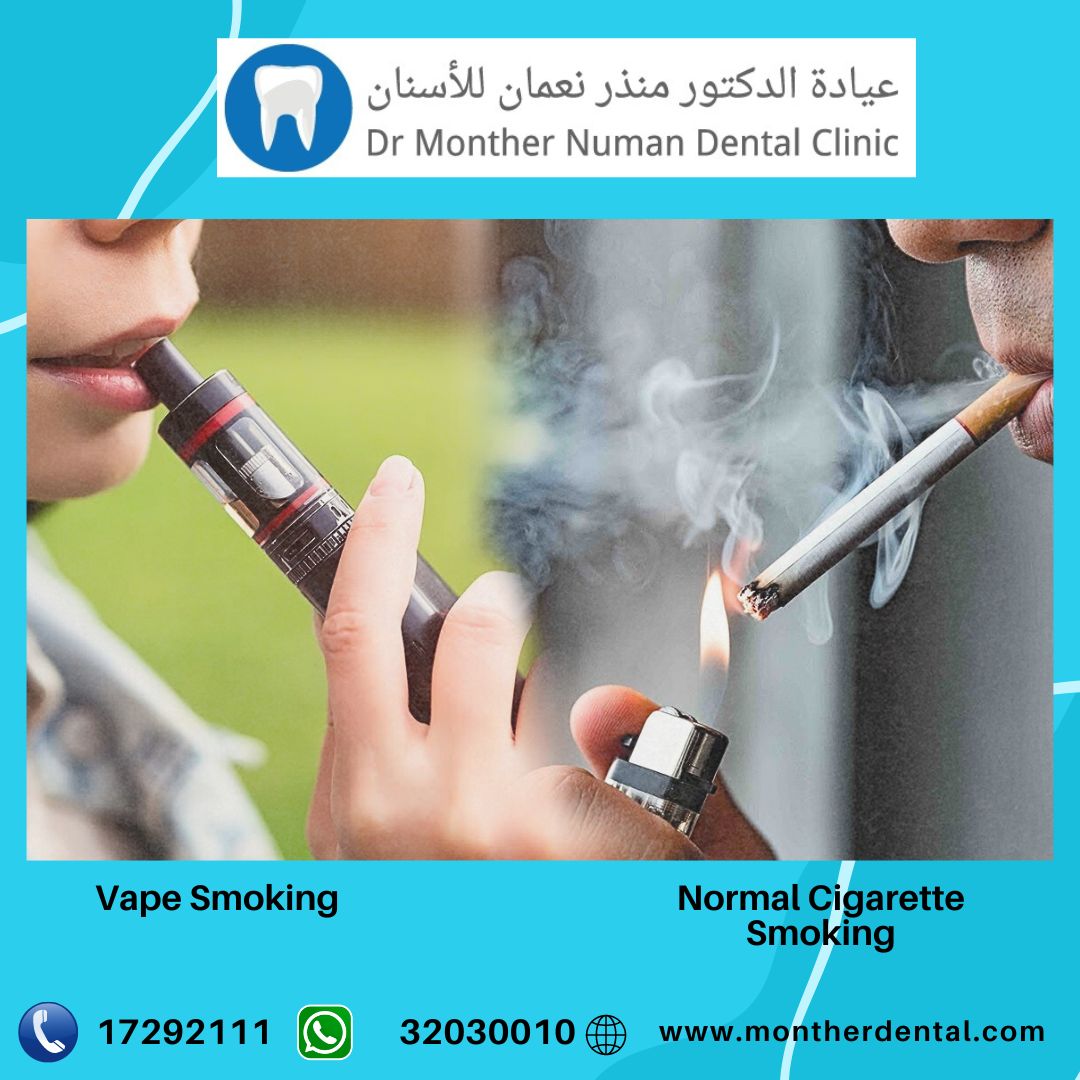 Smoking Cigarette and Vaping effects in Oral Health - Doctor Monther ...